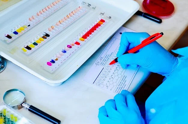 Wellbeing The Science Behind Condition Test Kits Explained