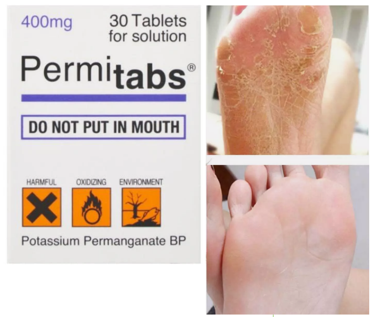 N-Potab Potassium Permanganate 30 BP Solution Tablets - Foot Care (Per
